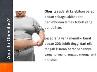 Obesitas | PPTX