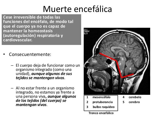 Muerte Encefálica Y Estado Vegetativo Persistente