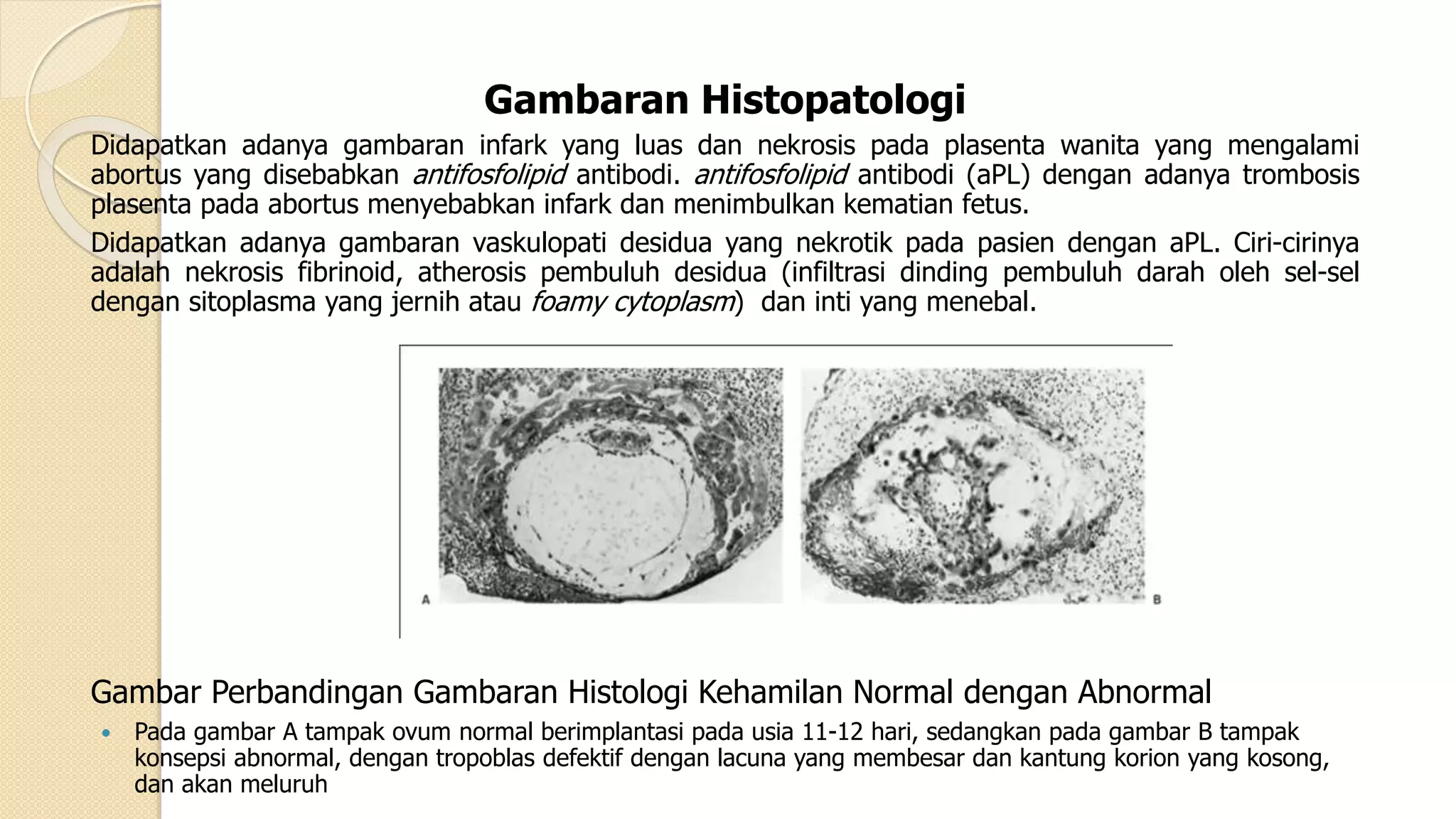 Ppt blighted ovum | PPTX