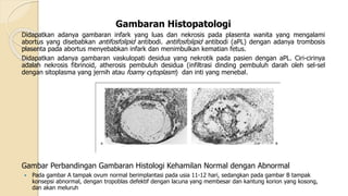 Ppt blighted ovum | PPTX