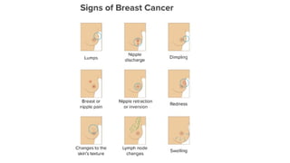 BREAST ANATOMY, PATHOLOGICAL DEFECTS AND CA-BREAST .pptx