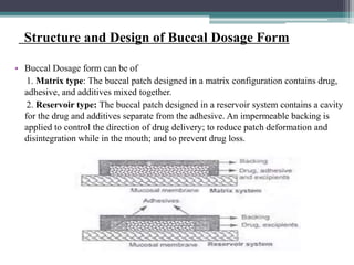 Buccal Drug Delivery System | PPTX