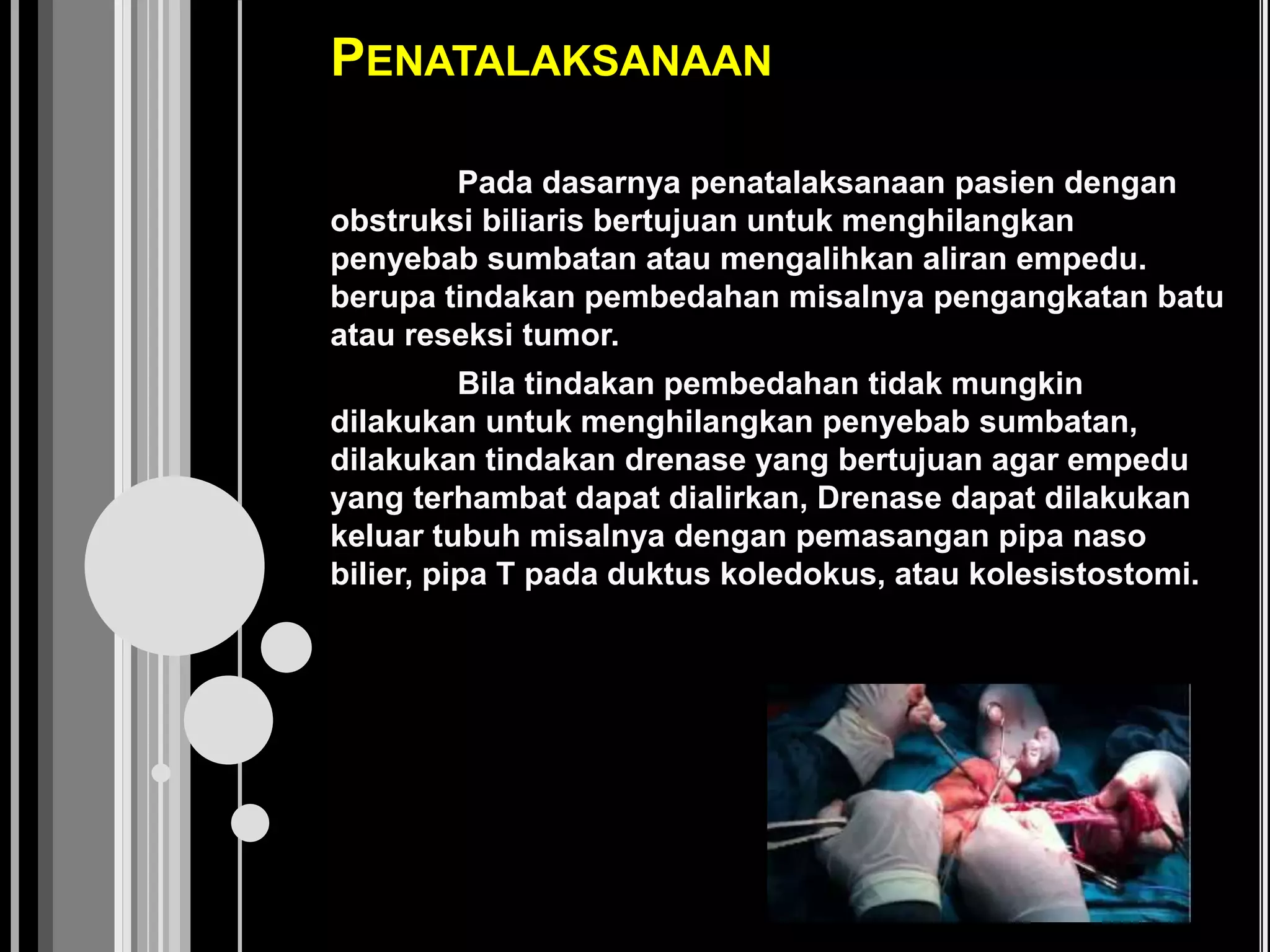 OBSTRUKSI BILIARIS | PPTX