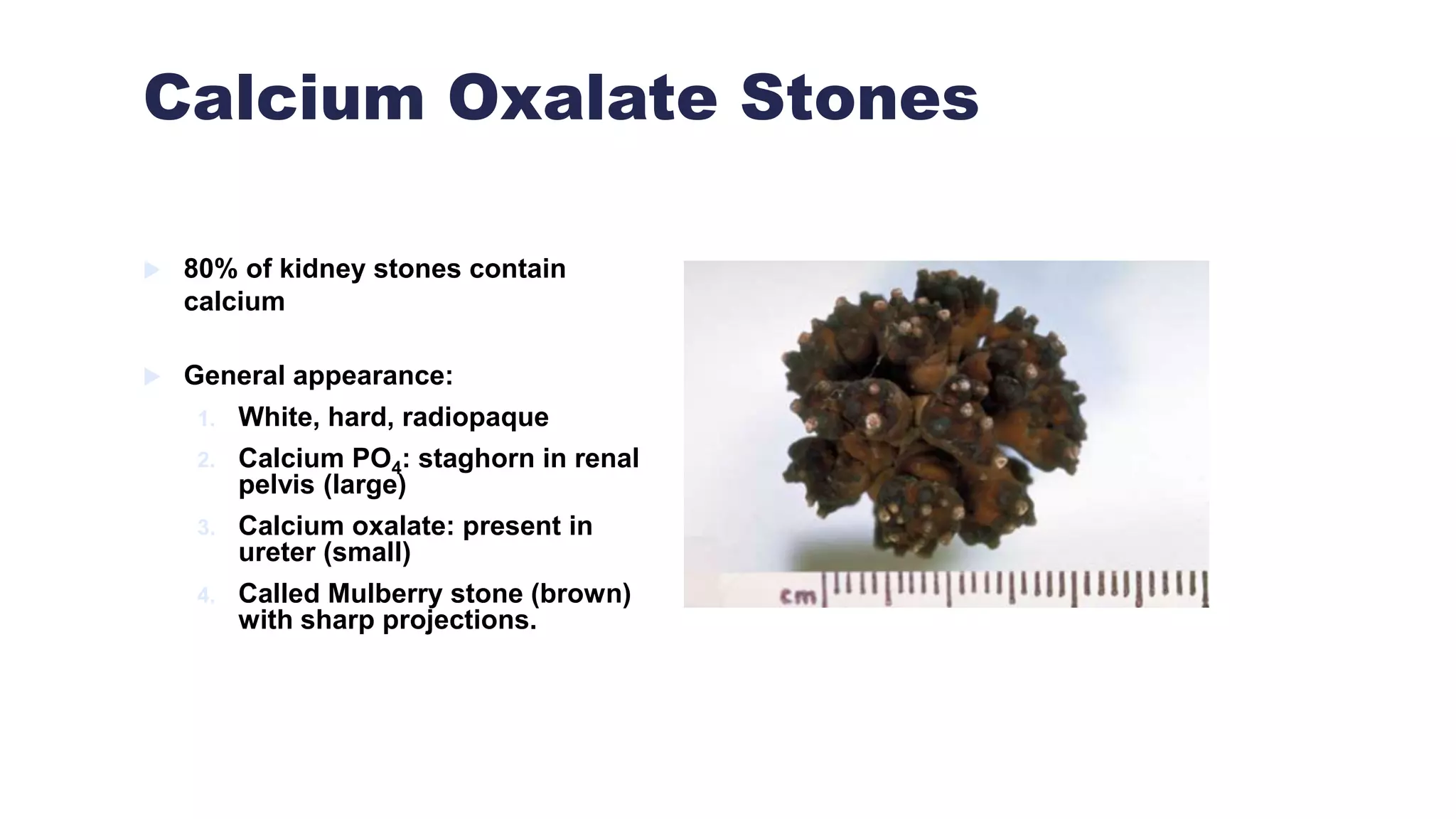Ppt by Basheer Oudah urolithiasis imaging | PPTX