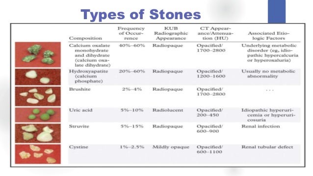 Four Types Of Kidney Stones