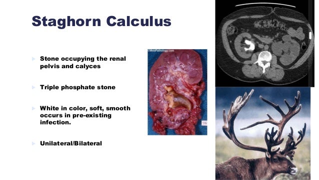 Ppt by Basheer Oudah urolithiasis imaging