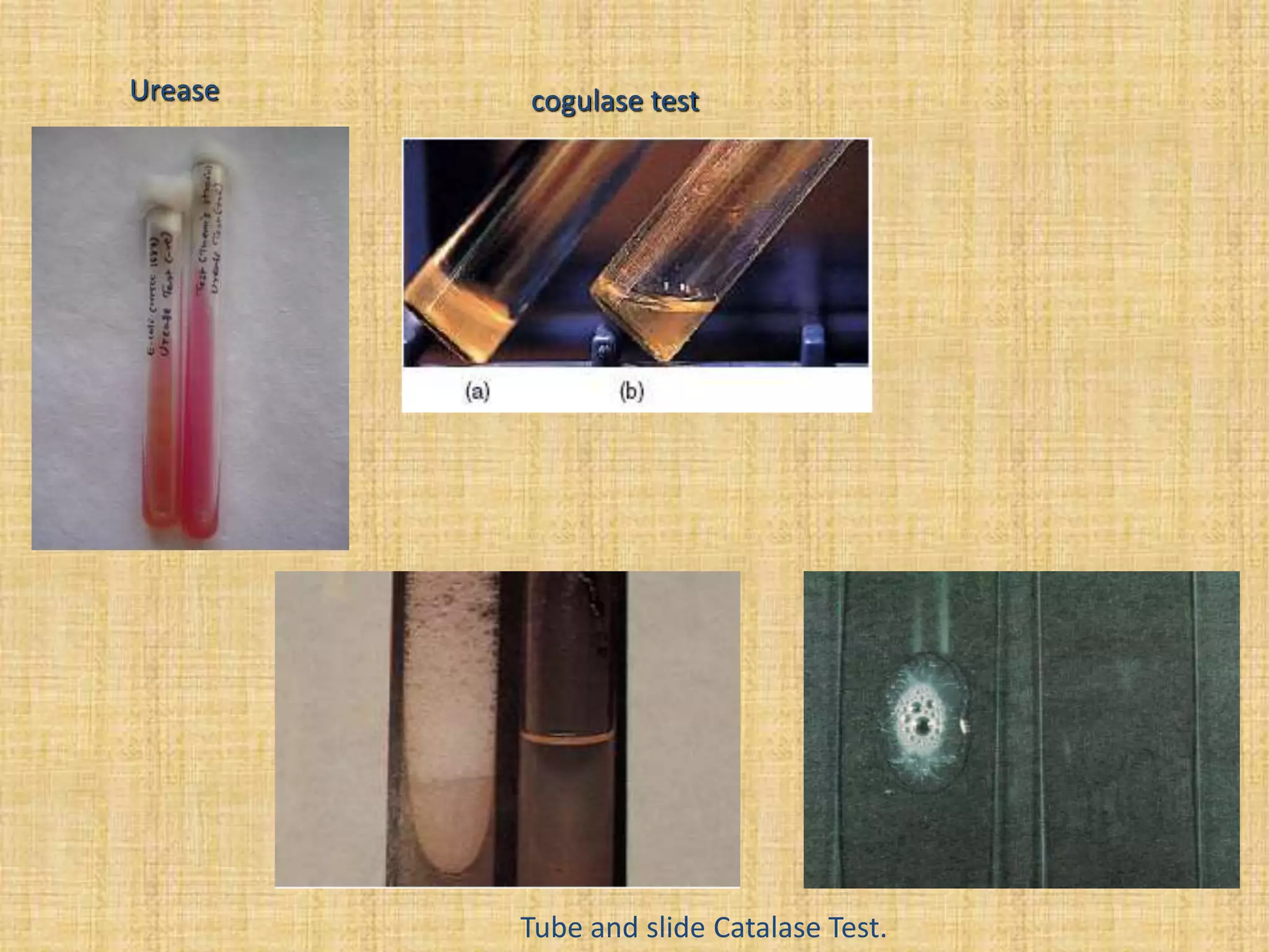 identification of bacteria | PPTX