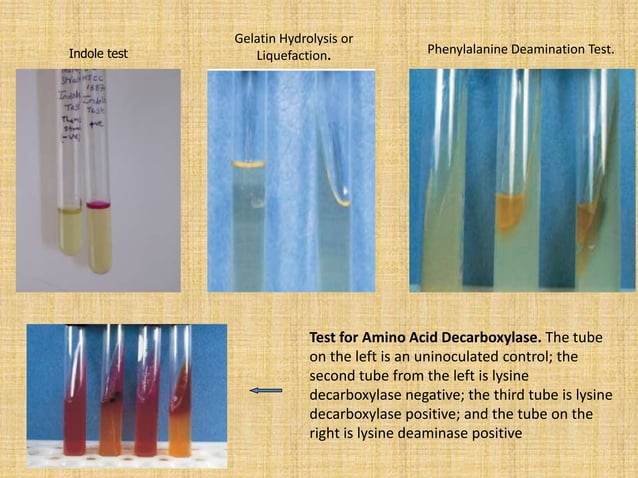 identification of bacteria | PPTX | Infectious Diseases | Diseases and ...