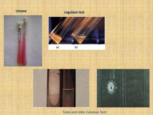 identification of bacteria | PPTX | Infectious Diseases | Diseases and ...