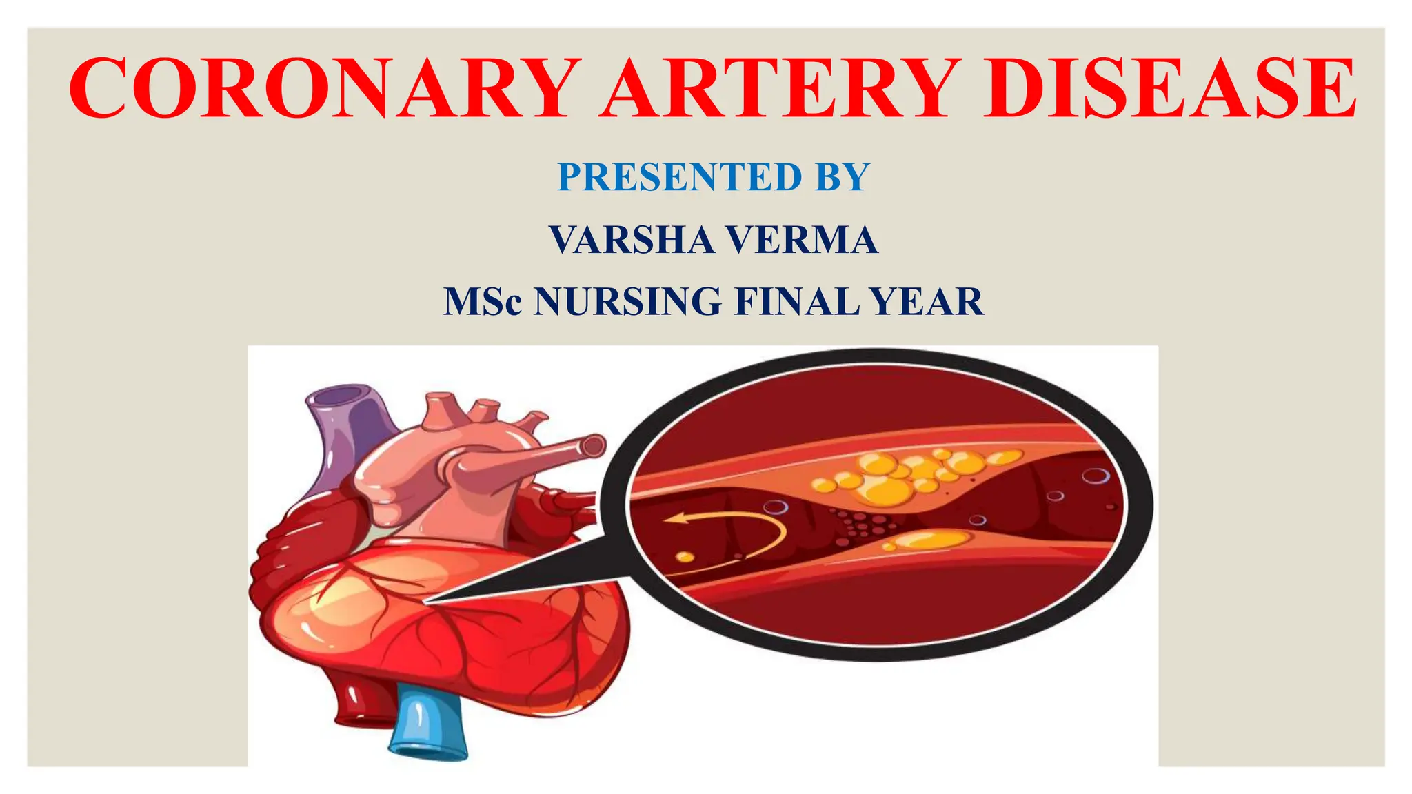 Coronary Artery Disease & Life Style Modification | PPTX