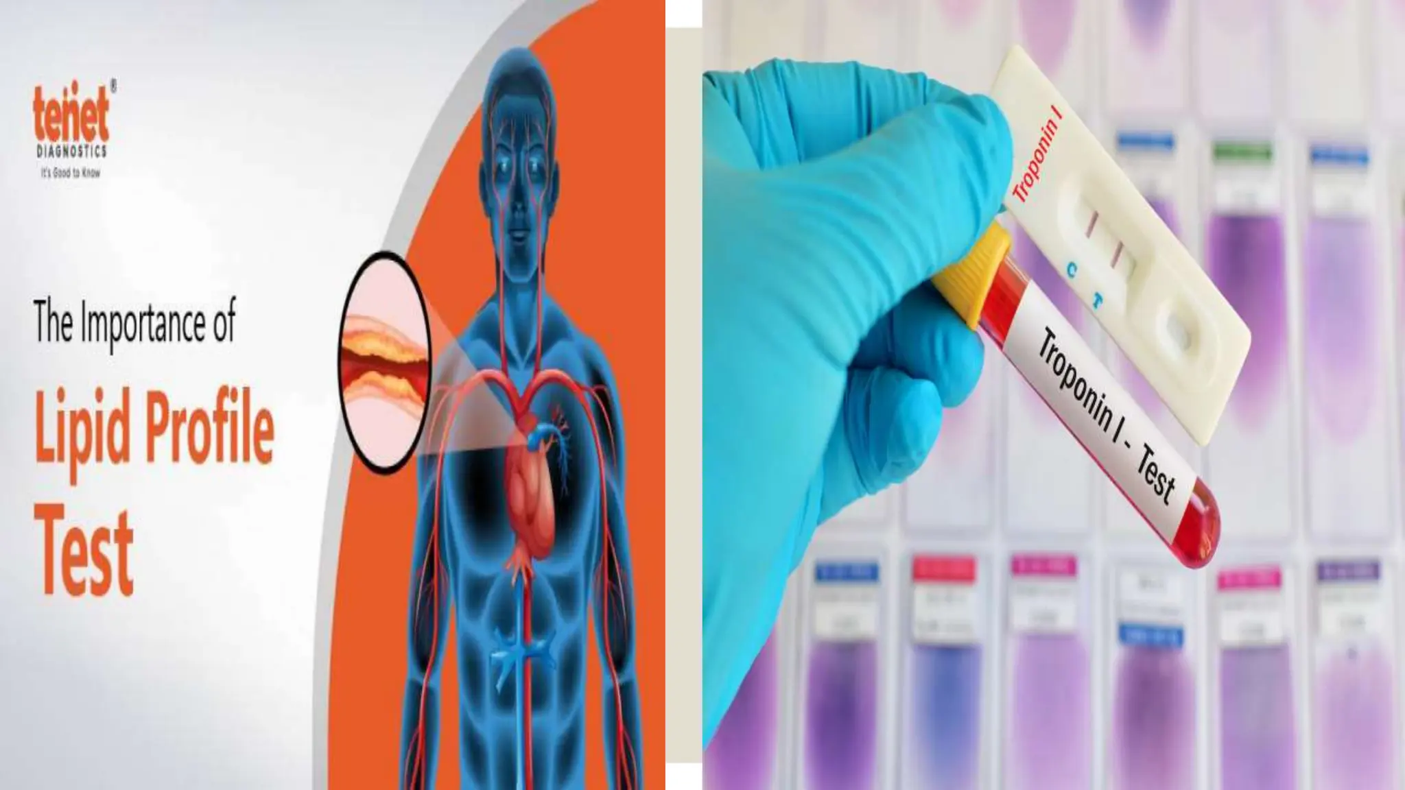 Coronary Artery Disease & Life Style Modification | PPTX