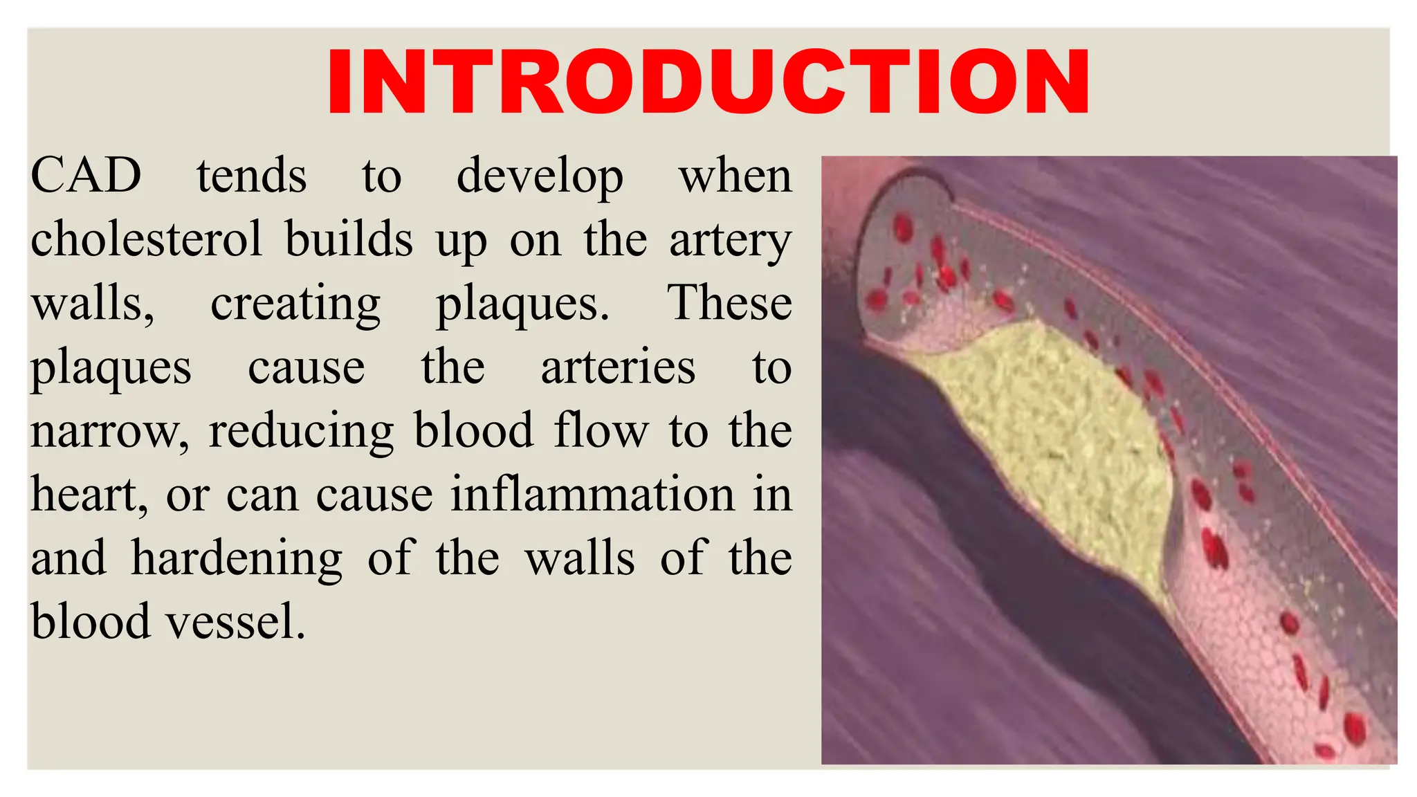 Coronary Artery Disease & Life Style Modification | PPTX