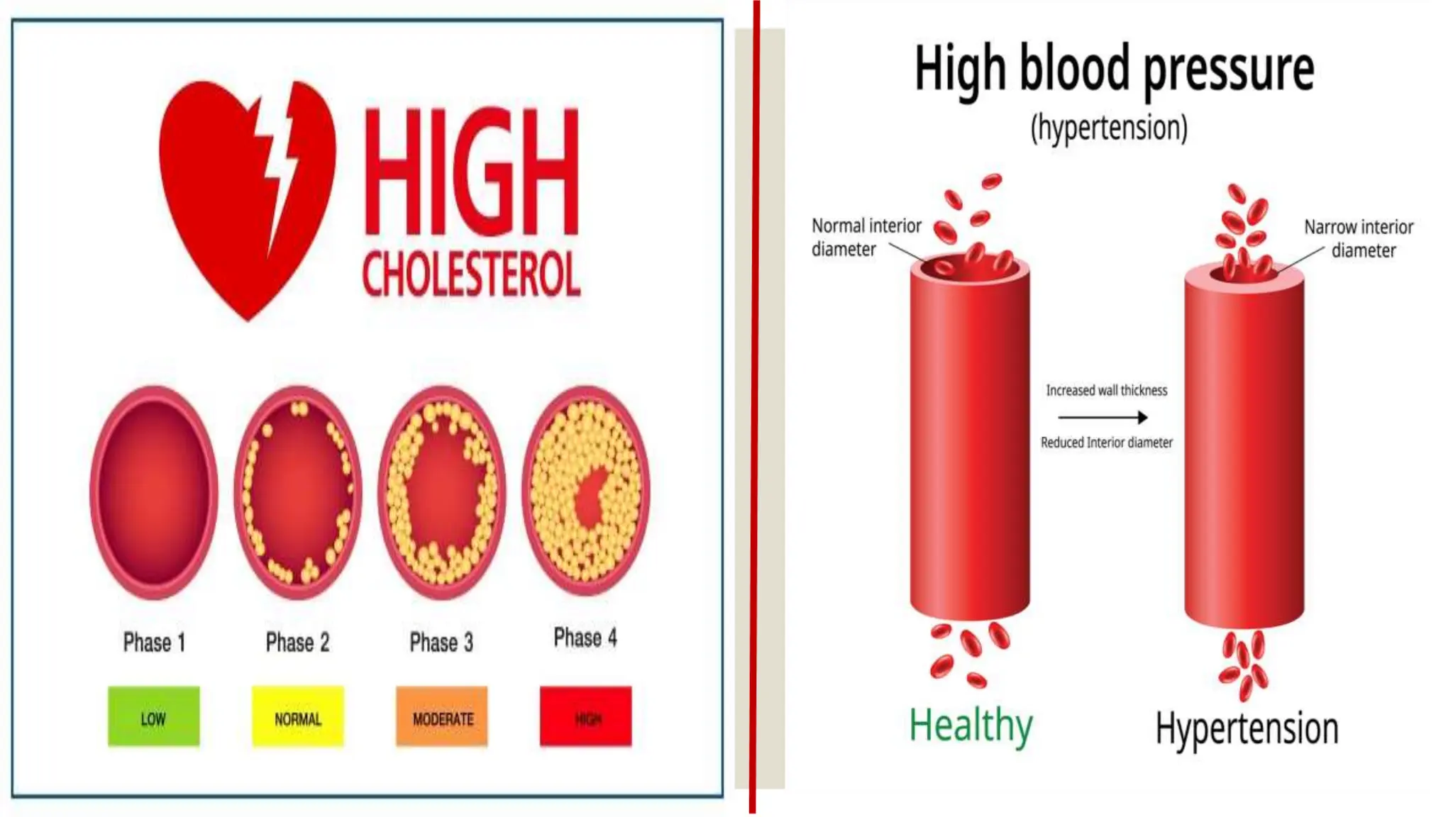 Coronary Artery Disease & Life Style Modification | PPTX