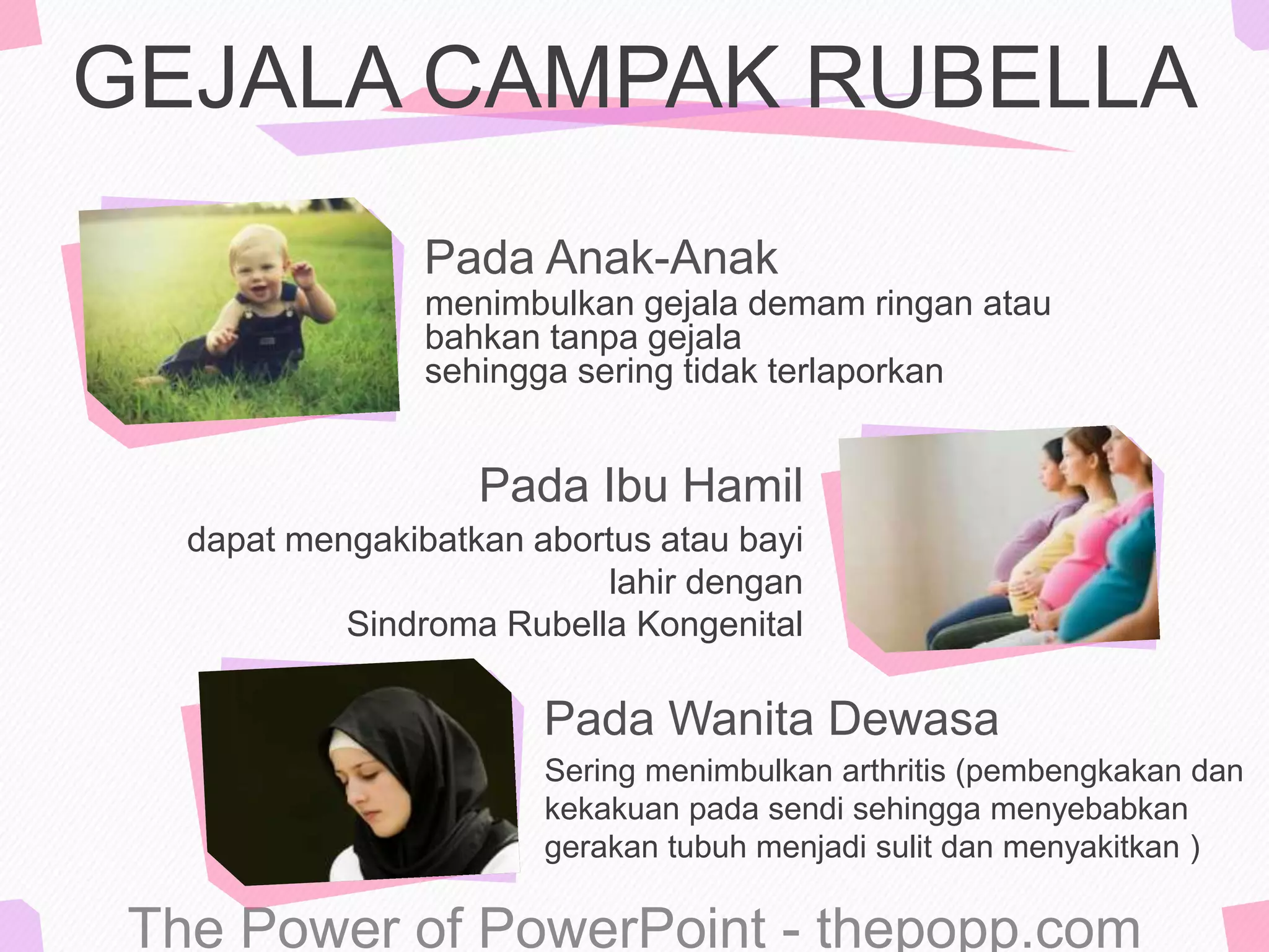 Ppt campak | PPTX