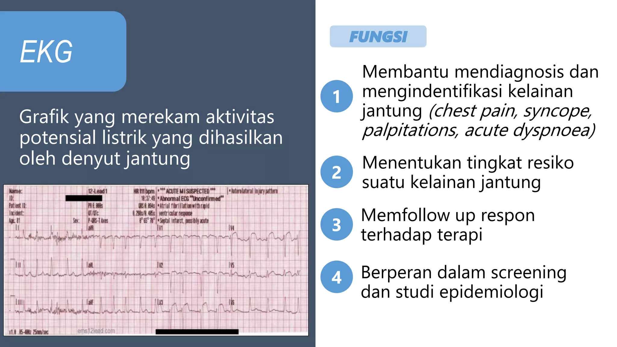 PPT CARDIO - EKG.pptx