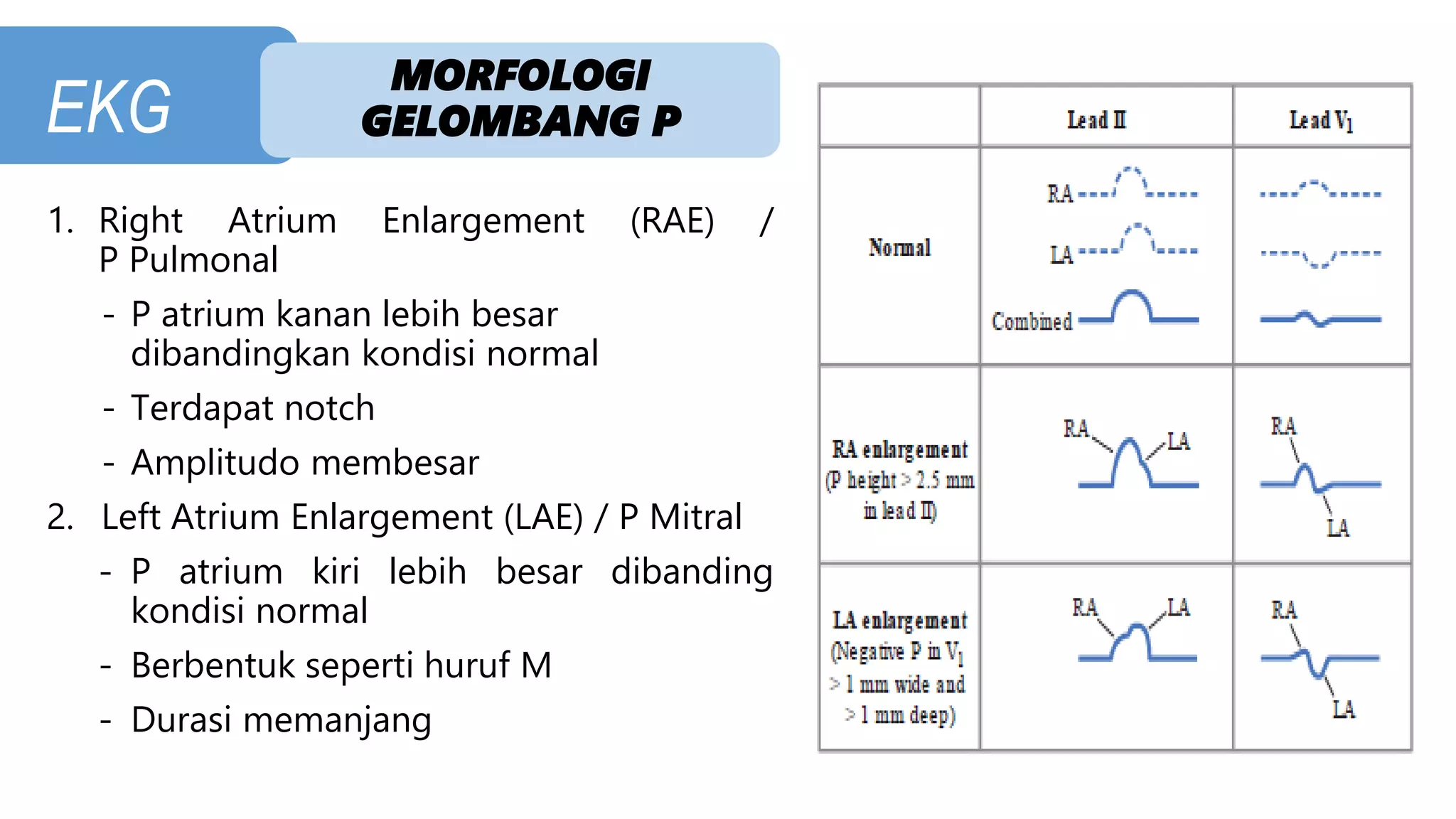 PPT CARDIO - EKG.pptx
