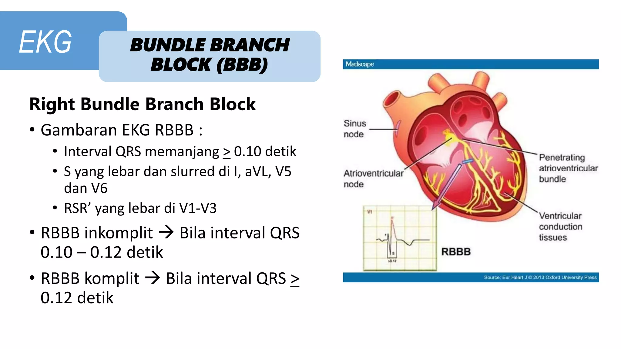 PPT CARDIO - EKG.pptx