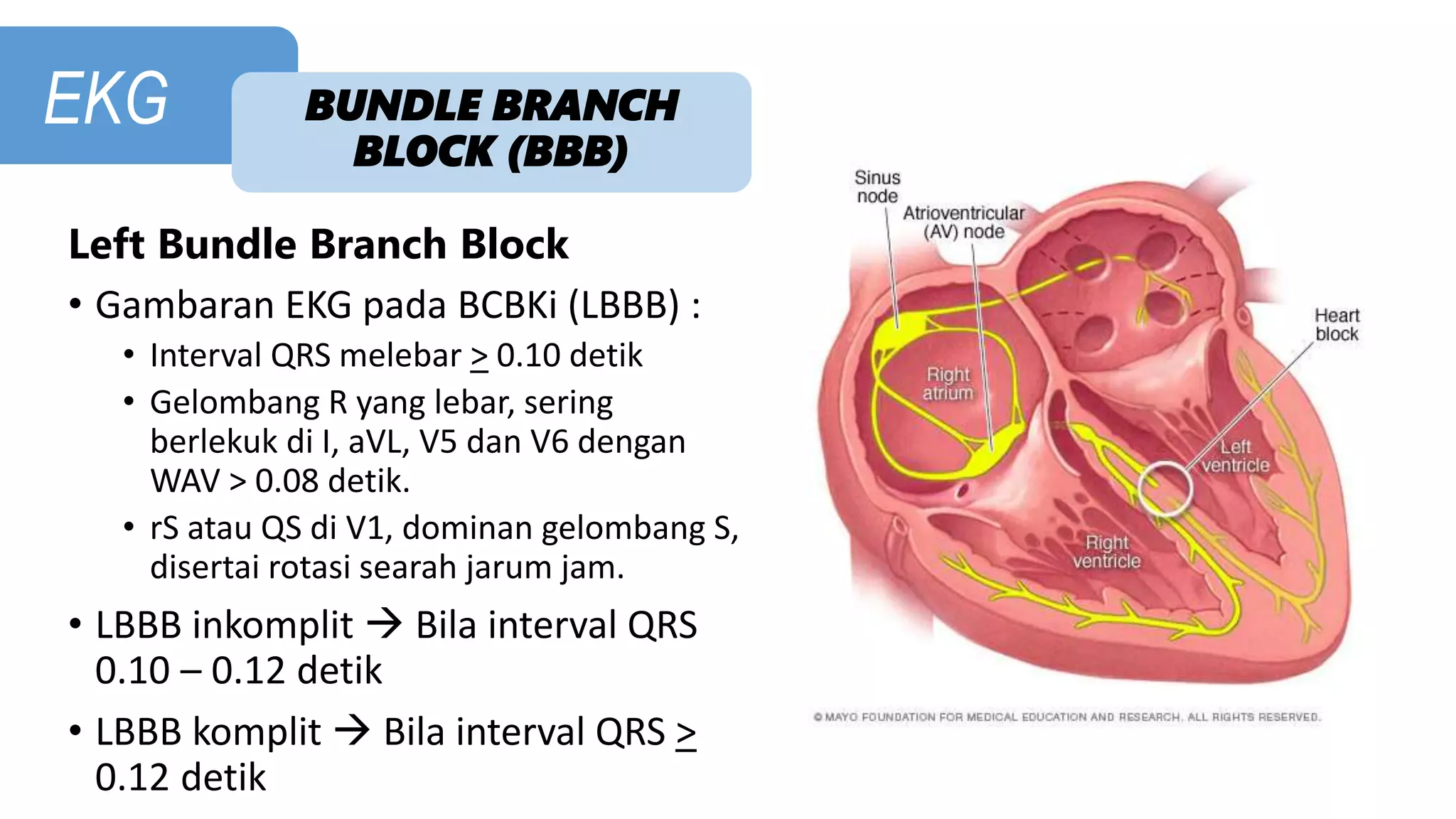 PPT CARDIO - EKG.pptx
