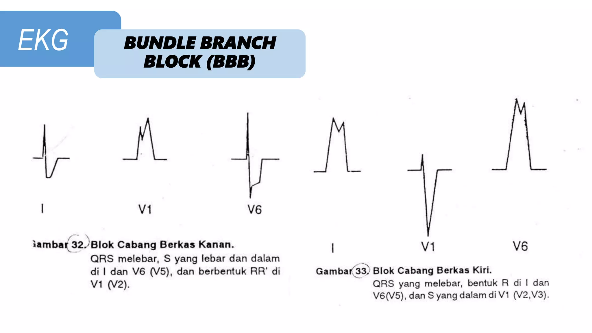 PPT CARDIO - EKG.pptx