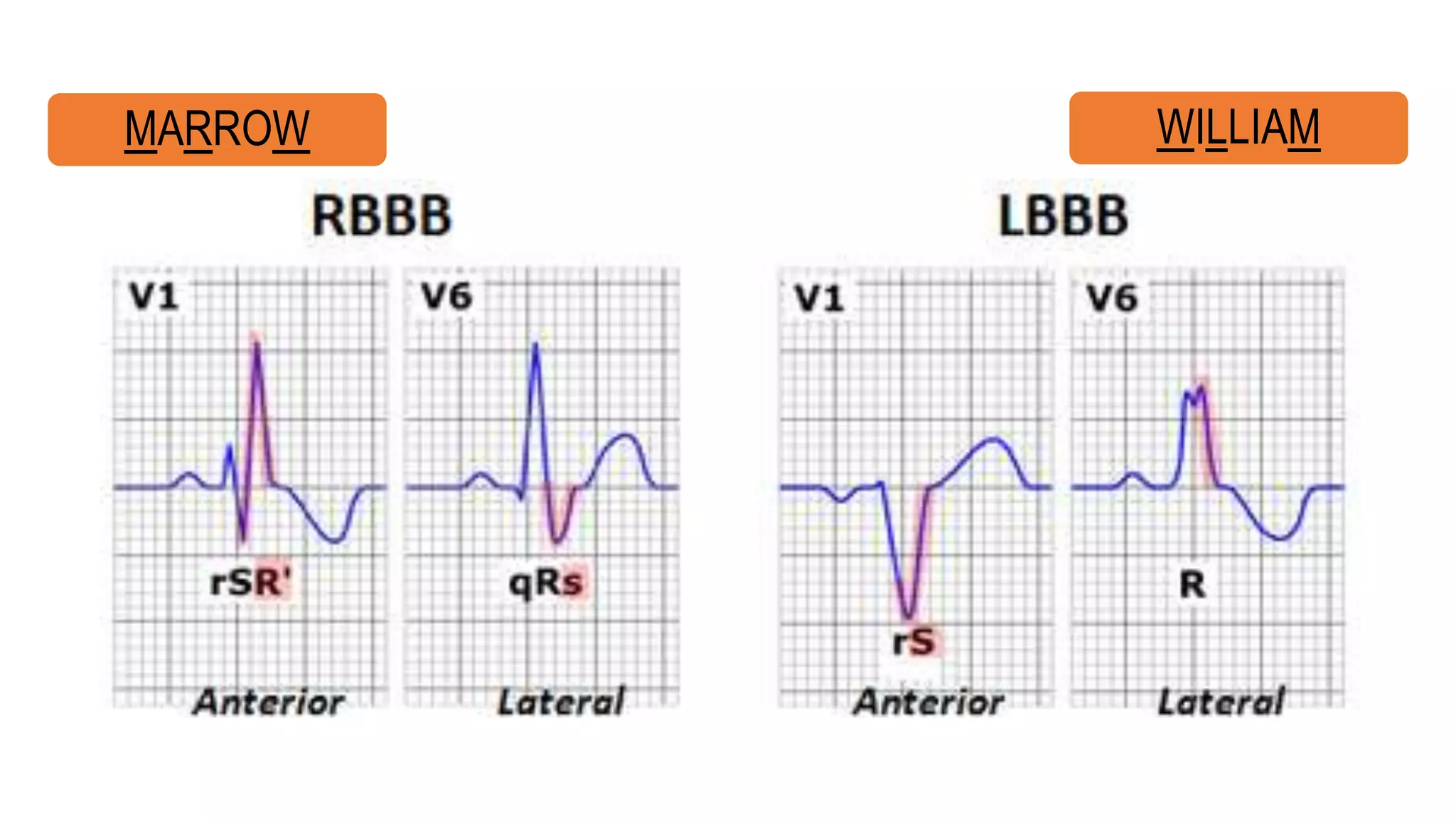 PPT CARDIO - EKG.pptx