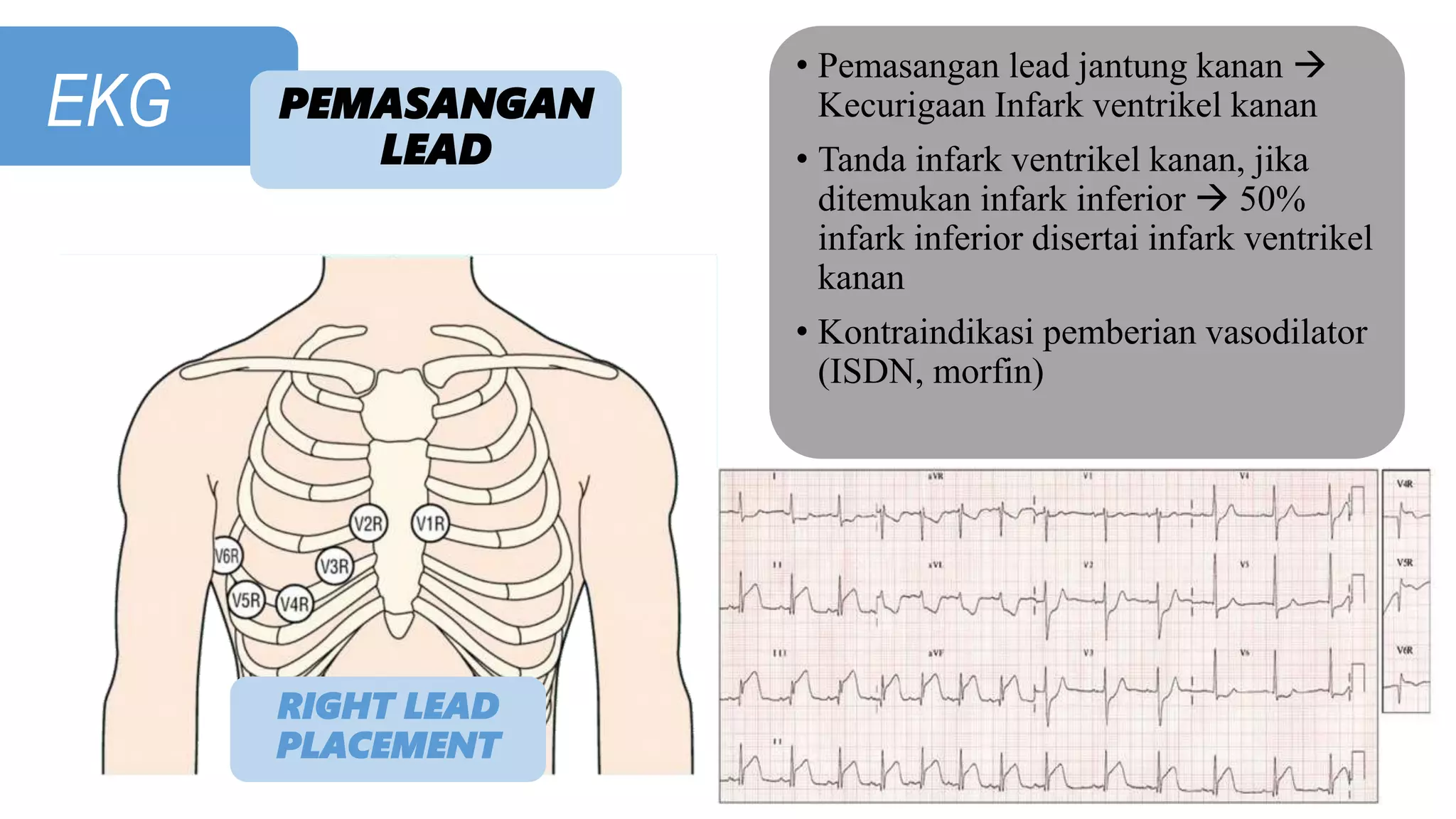 PPT CARDIO - EKG.pptx