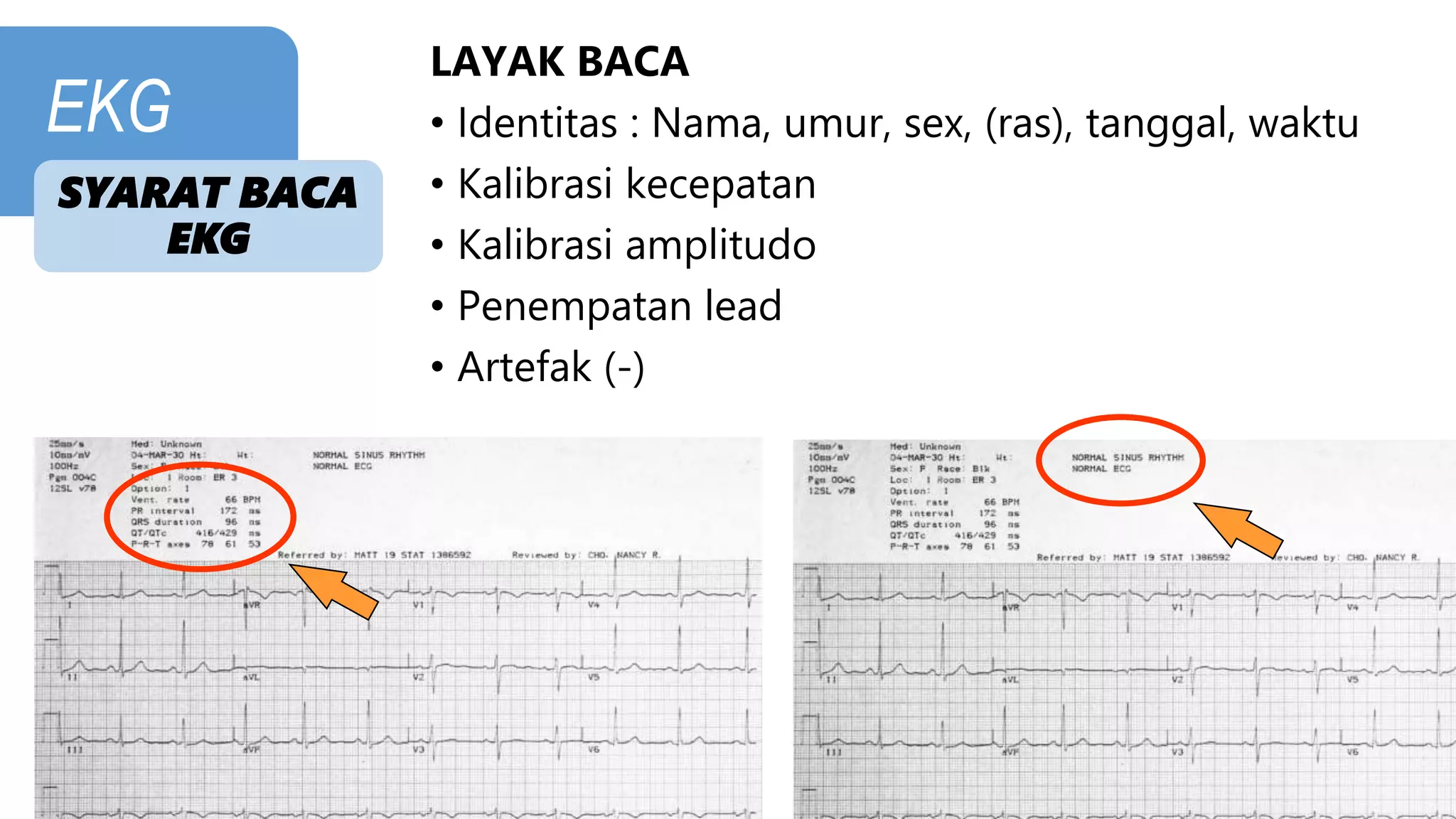 PPT CARDIO - EKG.pptx