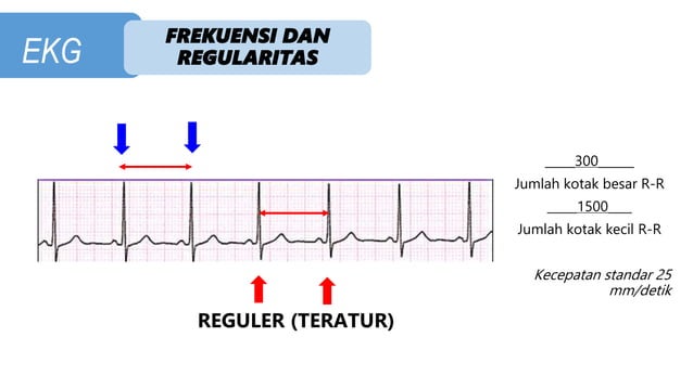 PPT CARDIO - EKG.pptx
