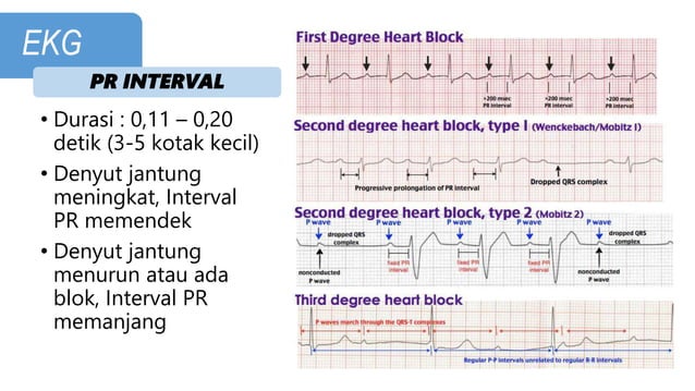 PPT CARDIO - EKG.pptx