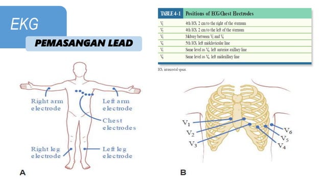 PPT CARDIO - EKG.pptx