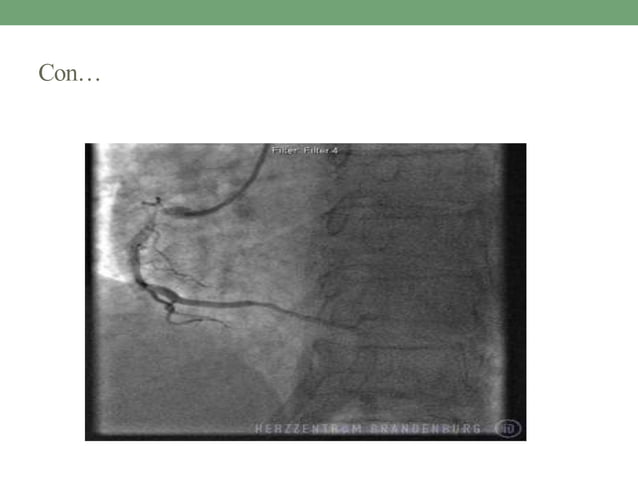PPt Cath lab preparation (1) (1).pptx