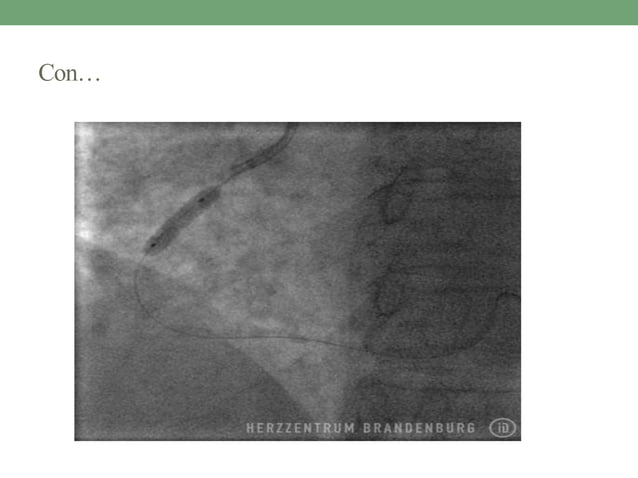 PPt Cath lab preparation (1) (1).pptx