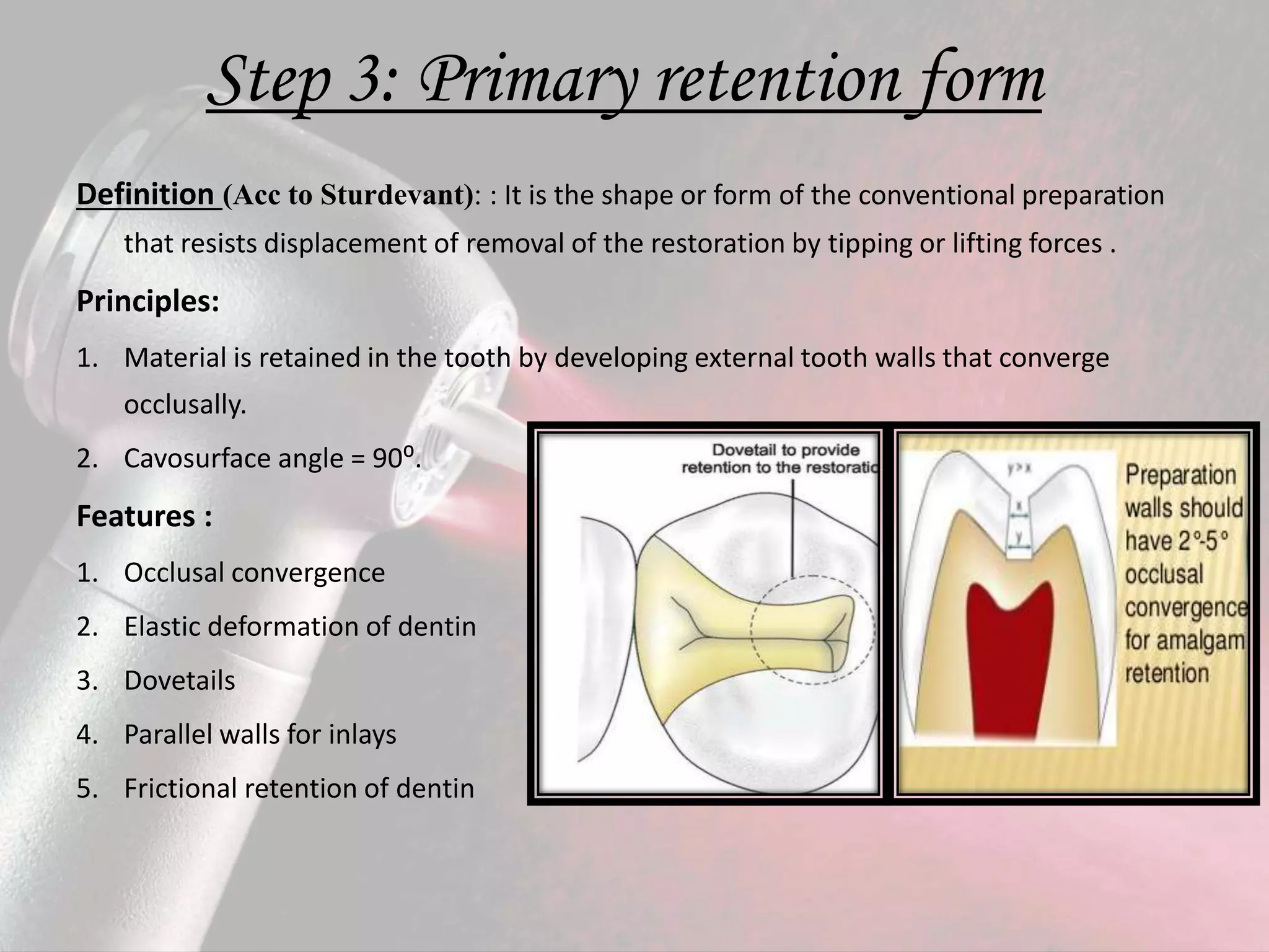 steps of cavity preparation for class 1 | PPTX