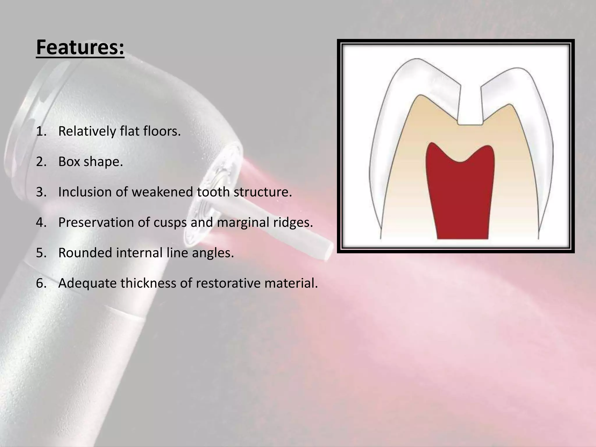 steps of cavity preparation for class 1 | PPTX