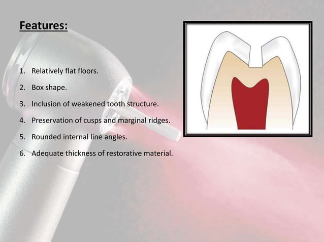 steps of cavity preparation for class 1 | PPTX
