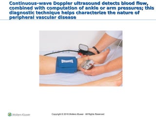 Assessment and Management of Patients With Vascular Disorders and ...