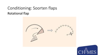 Chimes Skin flaps workshop | PPTX