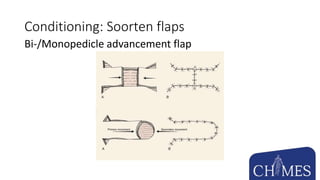 Chimes Skin flaps workshop | PPTX