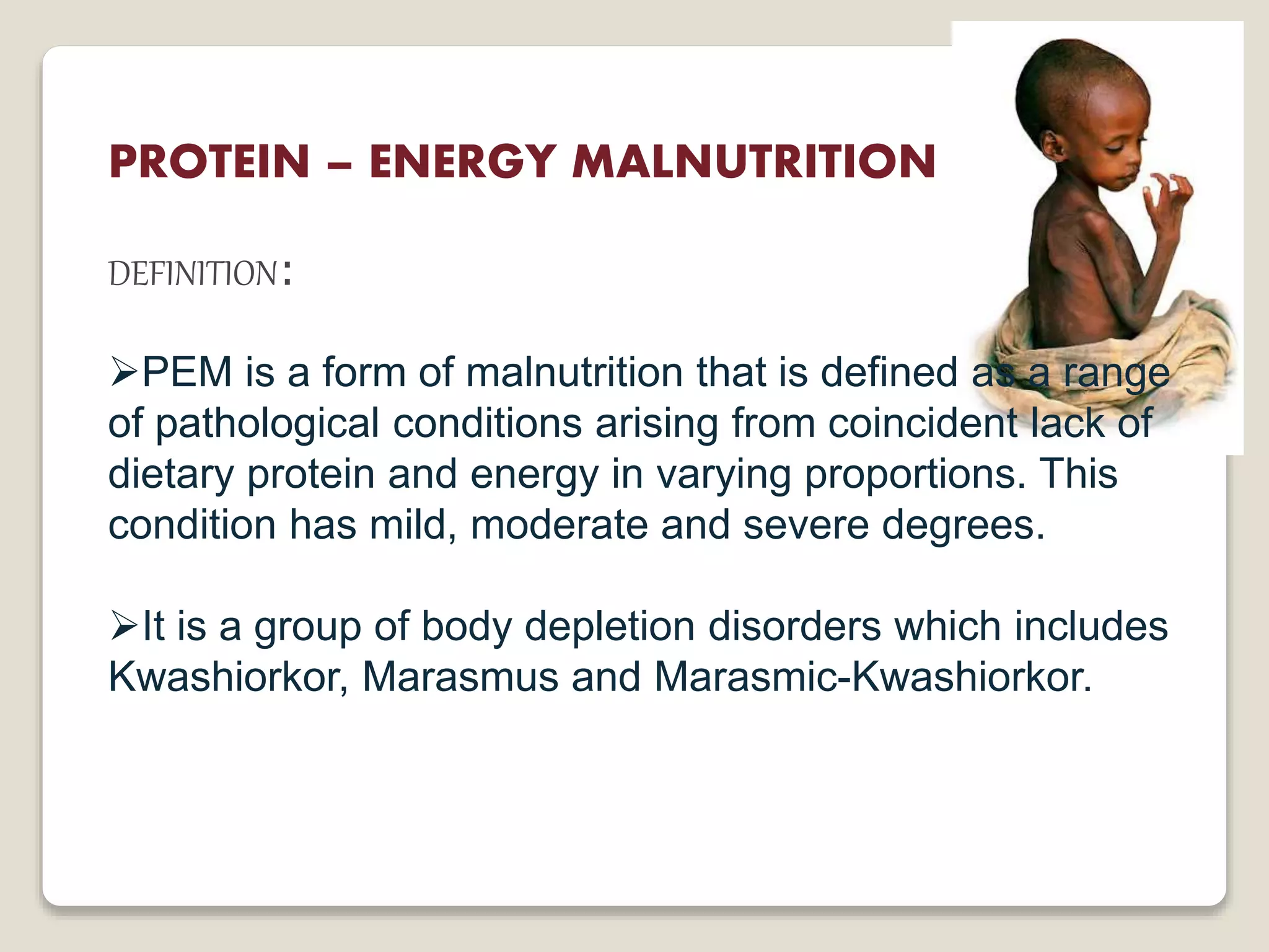 Protein energy malnutrition(PEM) | PPTX