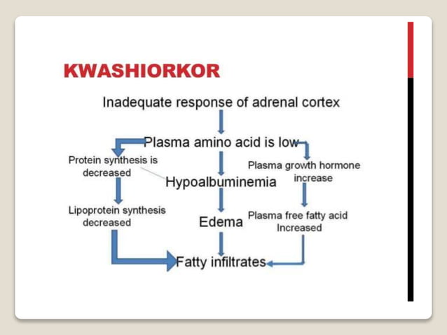 Protein energy malnutrition(PEM) | PPTX | Blood Disorders | Diseases ...