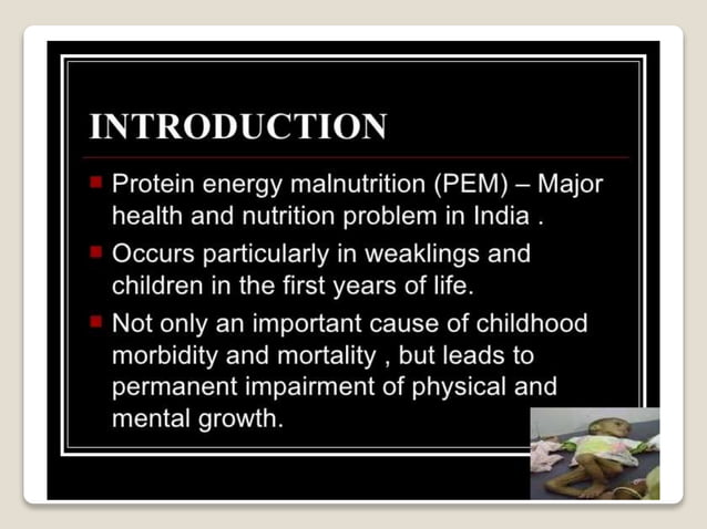 Protein energy malnutrition(PEM) | PPTX | Blood Disorders | Diseases ...
