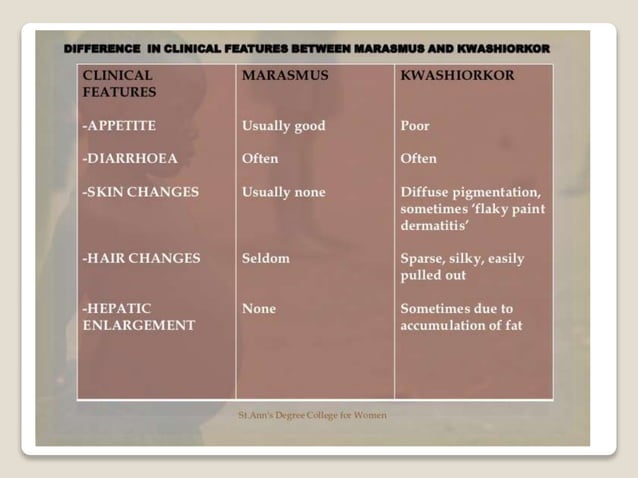 Protein energy malnutrition(PEM) | PPTX | Blood Disorders | Diseases ...