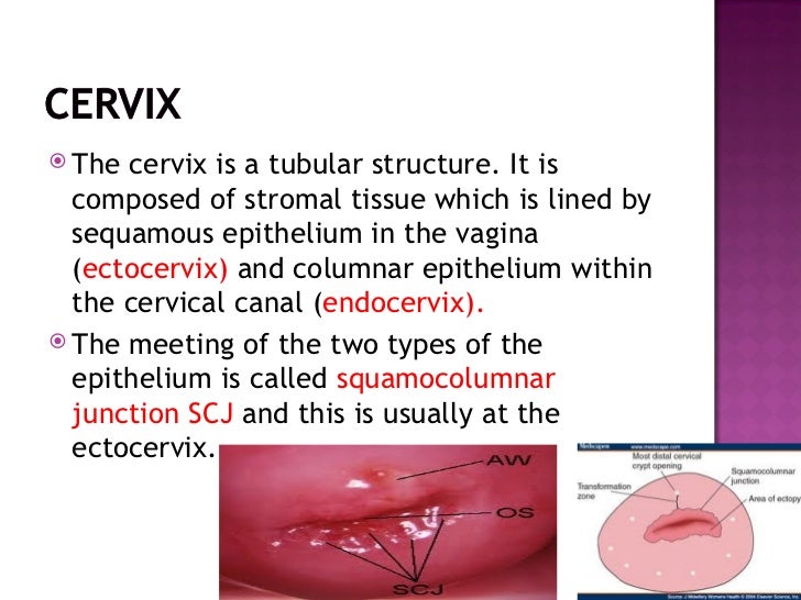 Endocervix Meaning Pathology Outlines - Inflammation - General