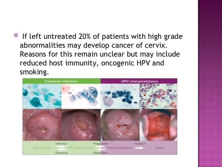 gynaecology.CIN.(dr.mraim)