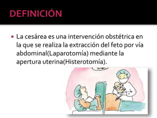 CESAREA TRANS PERITONEAL - CSTP | PPTX