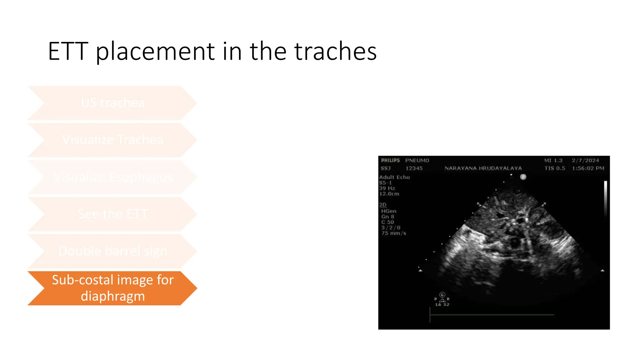 ETT ultrasound; ultrasonography of endotracheal tube placement | PPTX