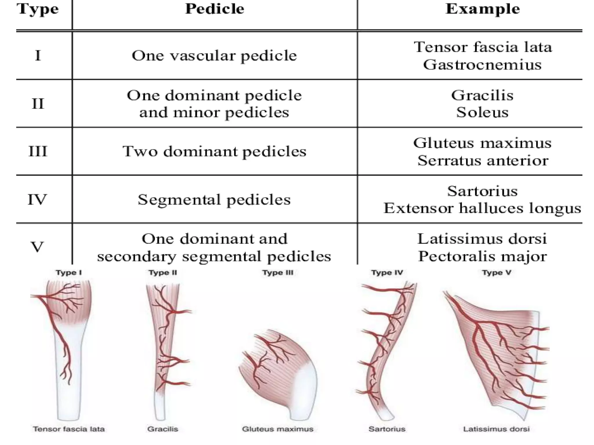 Classification of flaps | PPTX