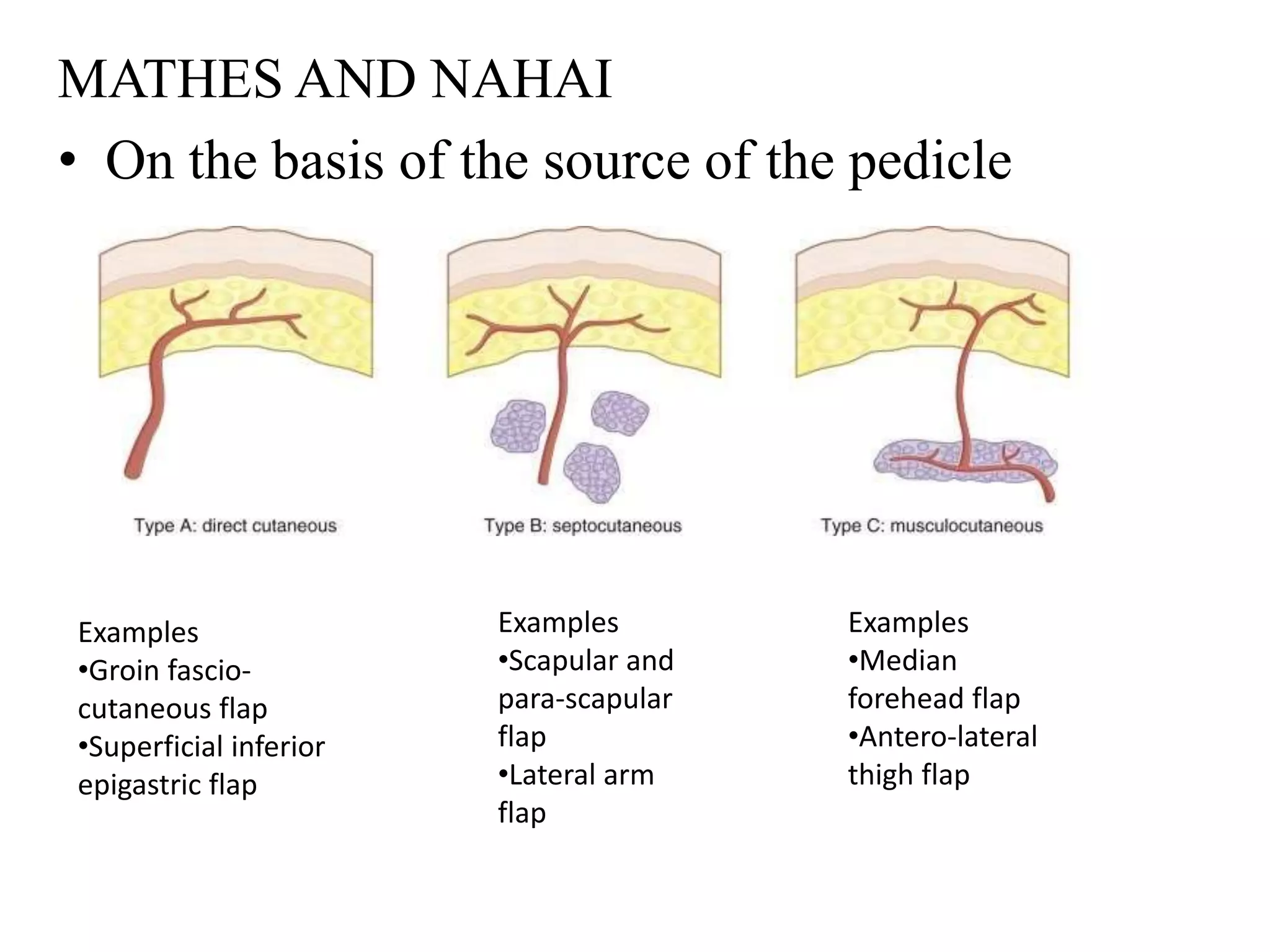 Classification of flaps | PPTX