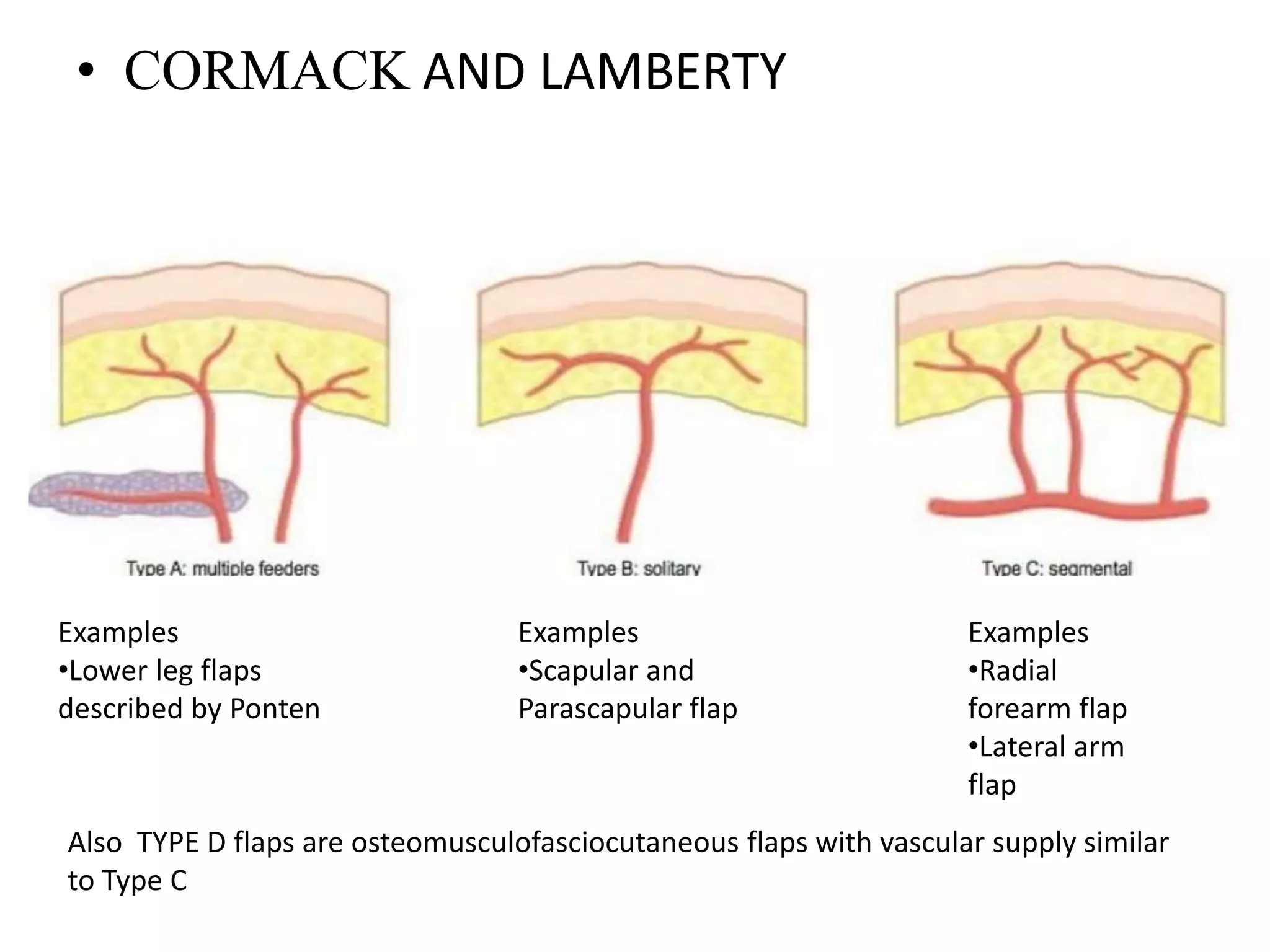 Classification of flaps | PPTX
