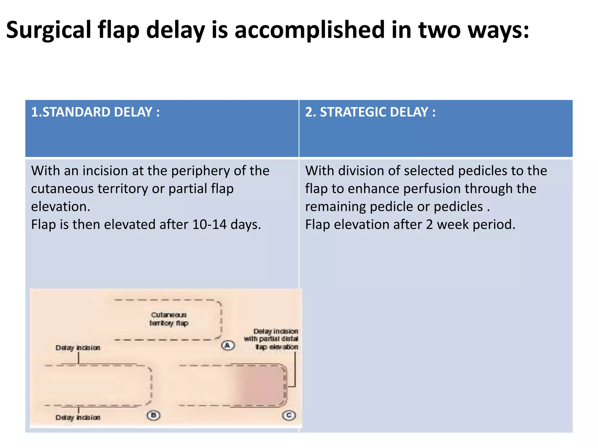 Classification of flaps | PPTX
