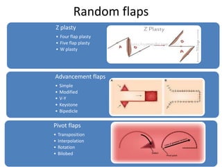 Classification of flaps | PPTX